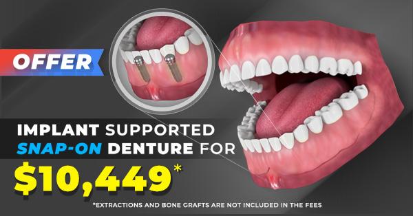 Lower Implant Supported Snap-on Denture | Ill-fitting Dentures | Rancho ...